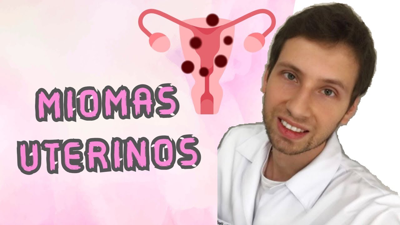 Miomas uterinos: causas, sintomas e tratamento - tudo o que você ...