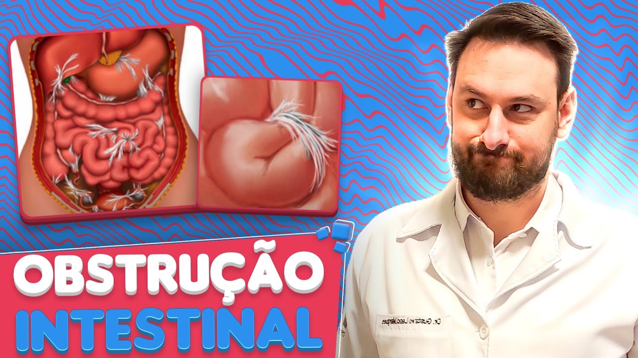 Obstrução Intestinal: Saiba os Sintomas, Tratamento e Causas