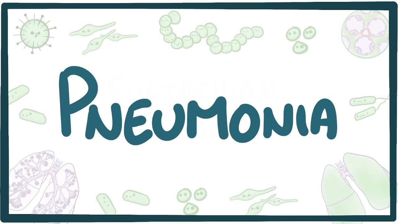 Pneumonia: Causes, Symptoms, Diagnosis, Treatment, and Pathology