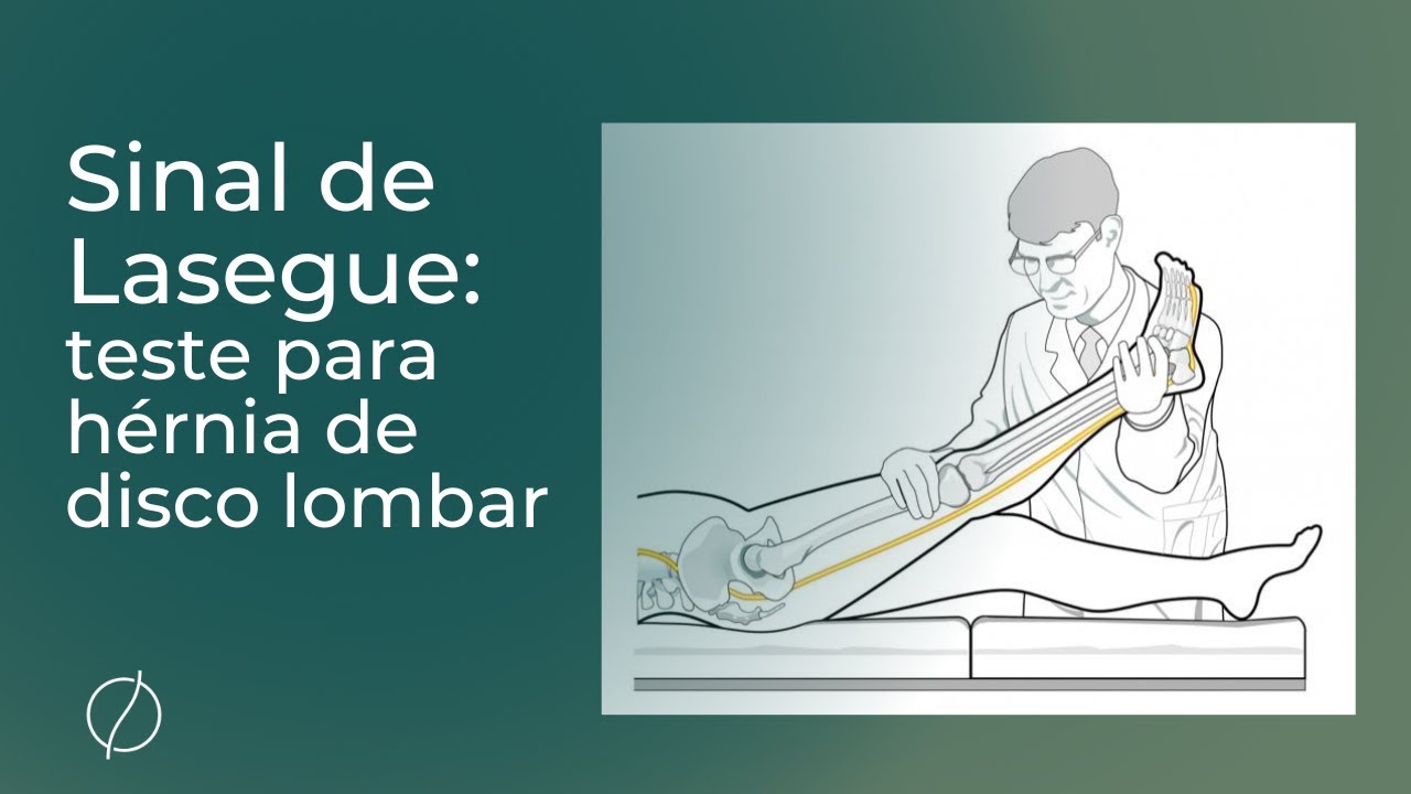 Sinal de Lasegue: teste diagnóstico para hérnia de disco lombar