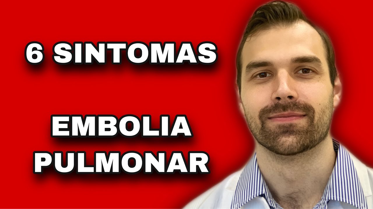 Sintomas de Embolia Pulmonar: Conheça os sinais de Trombose e o 6º ...