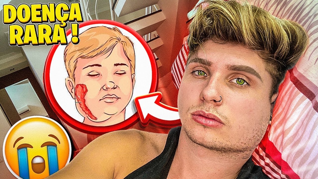 Sintomas e tratamentos para caxumba: tudo o que você precisa saber ...