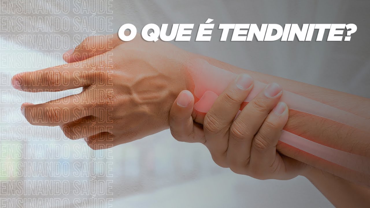 Tendinite: definição, causas e tratamentos.