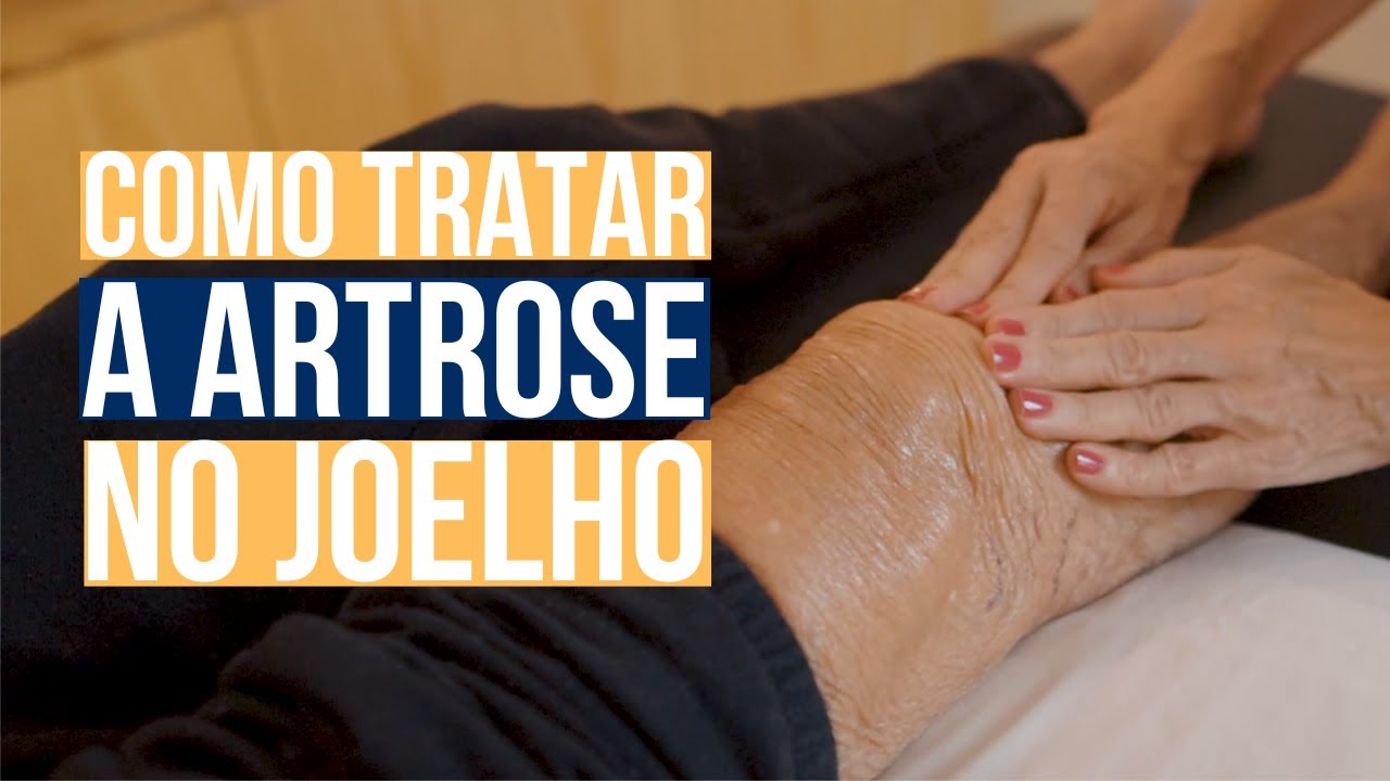 Tratamento eficaz para artrose no joelho: descubra o melhor método