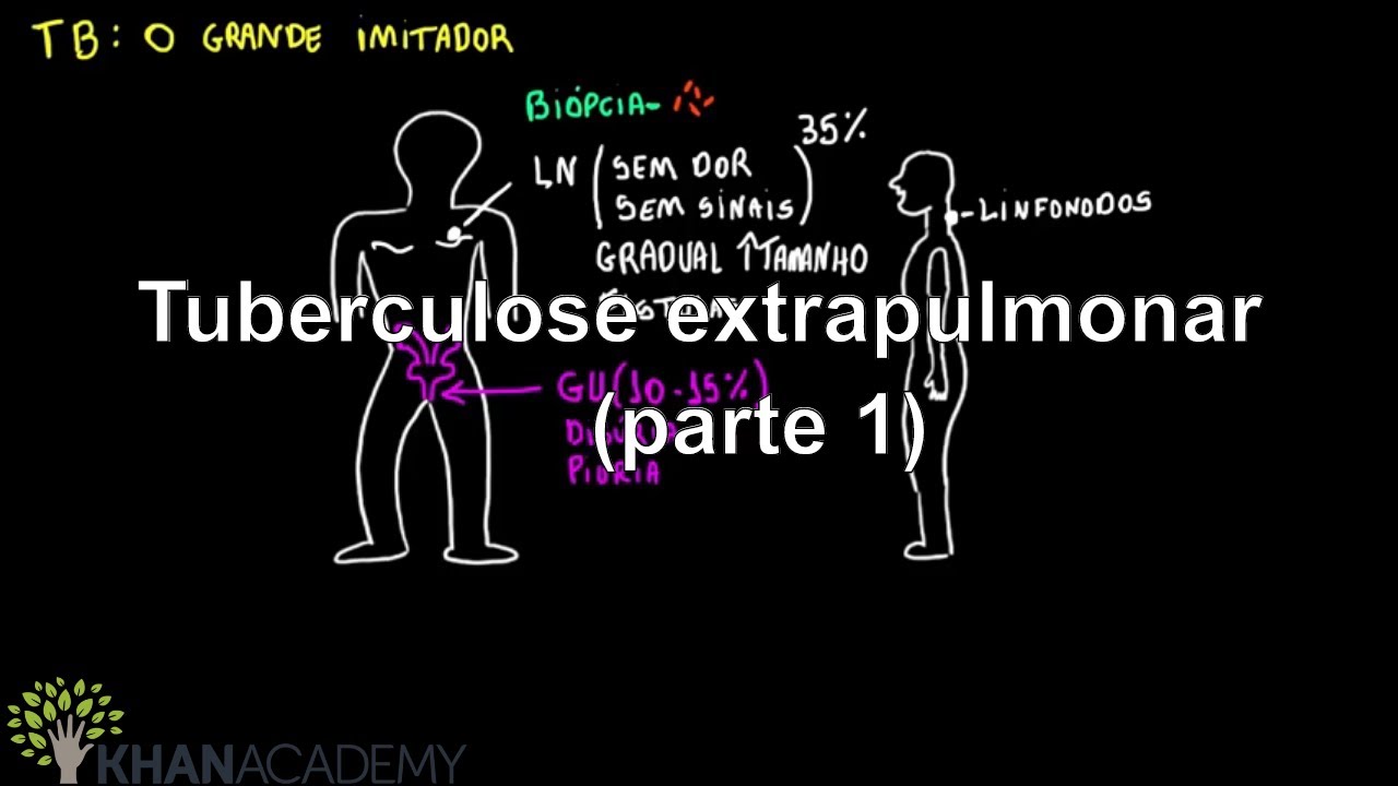 Tuberculose extrapulmonar: causas, sintomas e tratamento - Khan Academy
