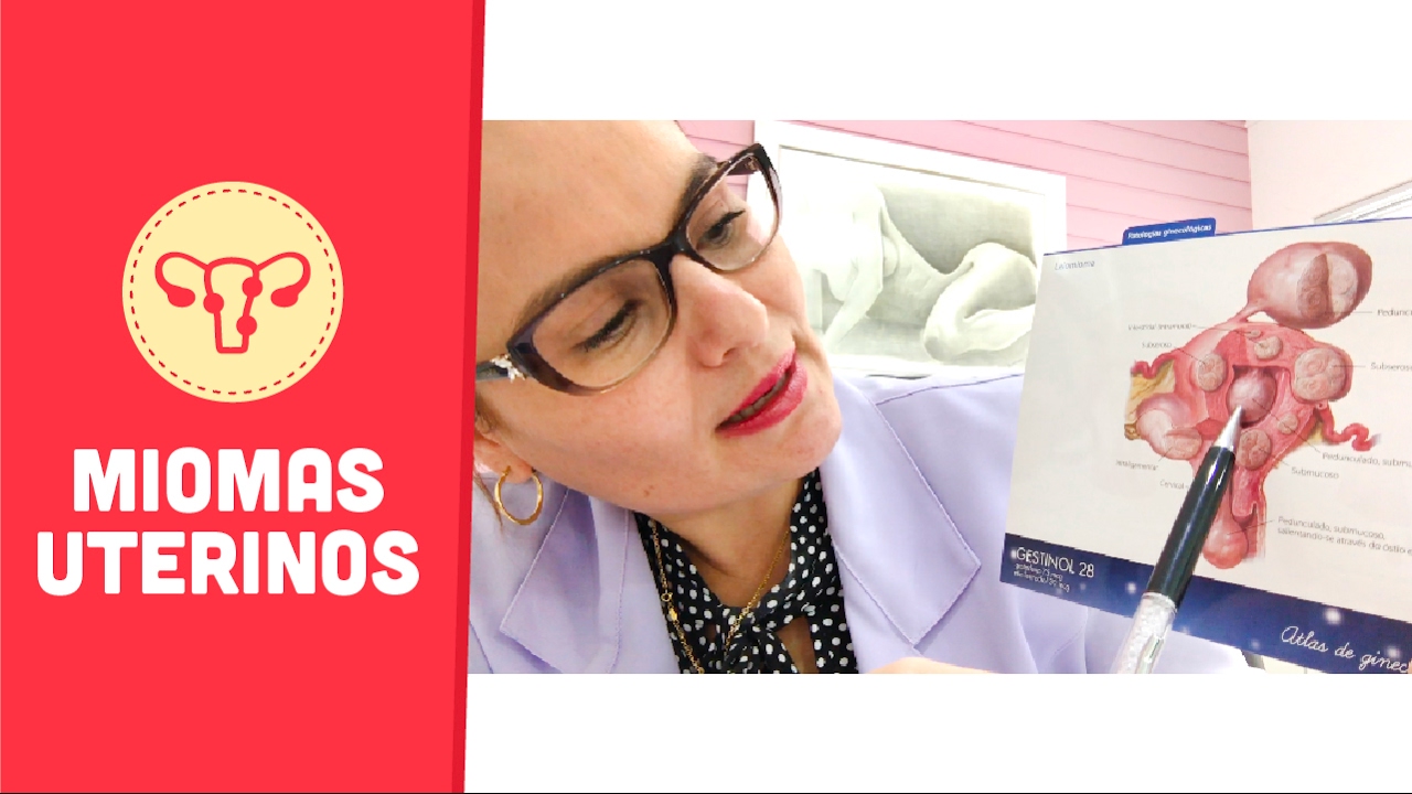 Tudo o que você precisa saber sobre miomas uterinos: causas, sintomas e tratamentos