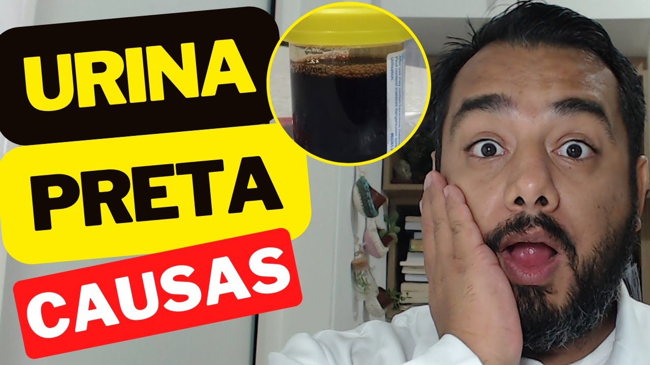 Urina preta: causas, sintomas e exame de urina para diagnóstico