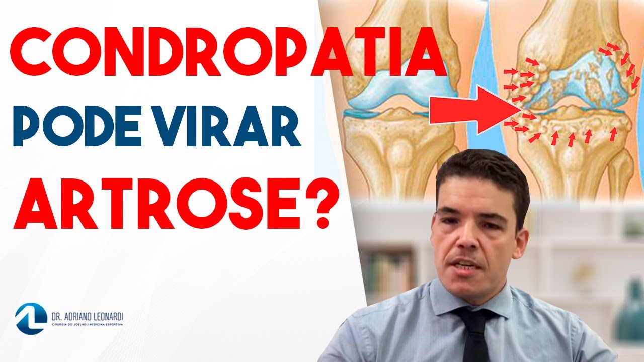 Condropatia: Causas, Sintomas e sua Relação com a Artrose