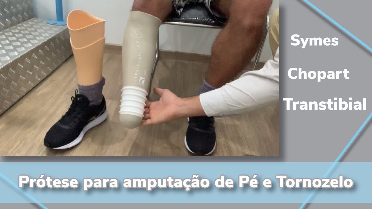 Prótese para amputação de pé e tornozelo: tipos e informações