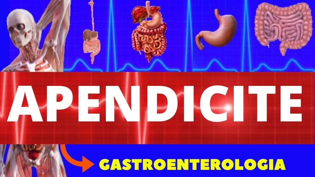 Tudo sobre apendicite: causas, sintomas, diagnóstico e tratamento da ...
